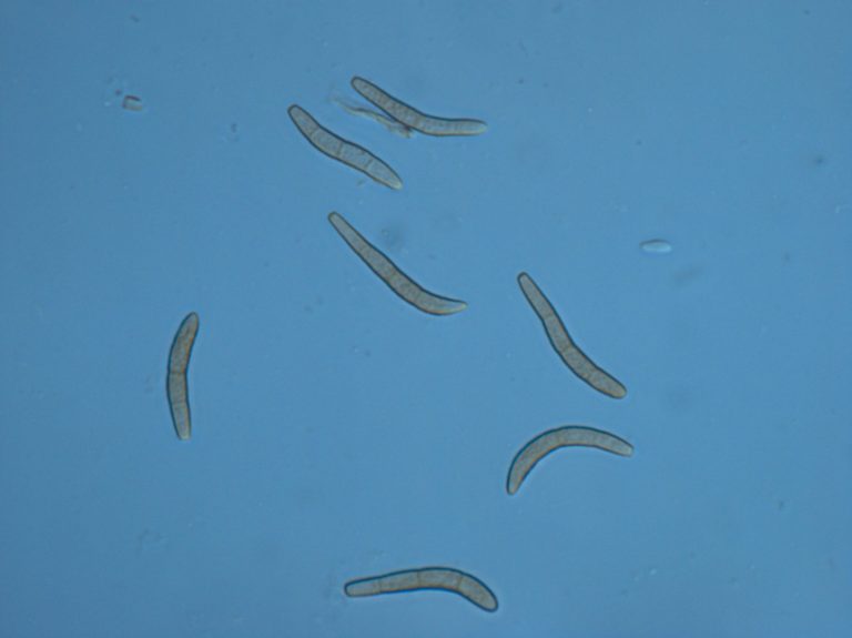 Red Band (Dothistroma) Needle Blight